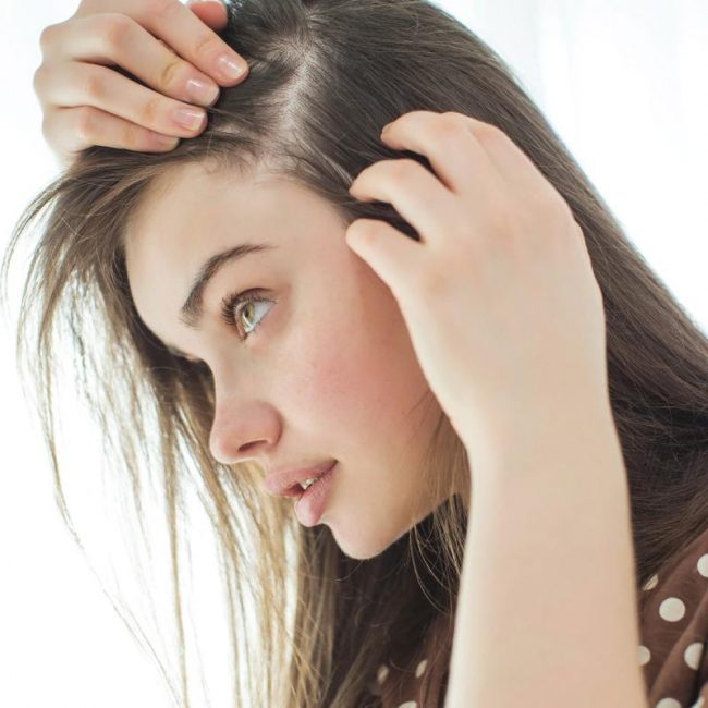 An Essential Guide To Get Rid Of Scabs On Scalp Overnight